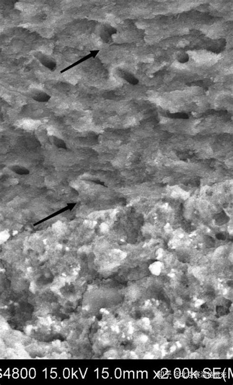 C Root Sp硅酸锶，口腔人理想的根管充填糊剂！ 知乎