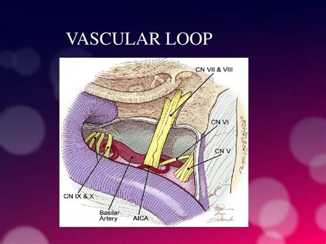 What Is A Small Vascular Loop At Jessica Fischer Blog