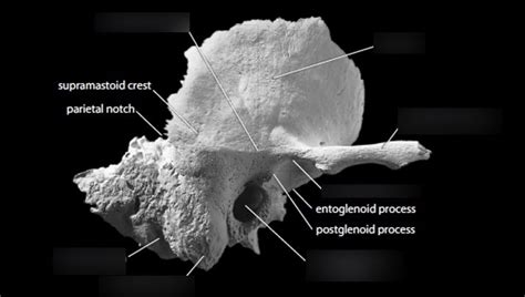 Temporal Diagram Quizlet