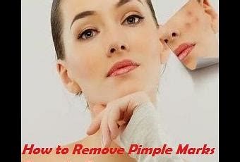 How To Remove Pimple Marks From The Face Paperblog
