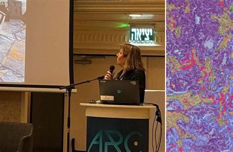 Deepathology Introduces Segmentation By Factorization An Innovative Unsupervised Pathology