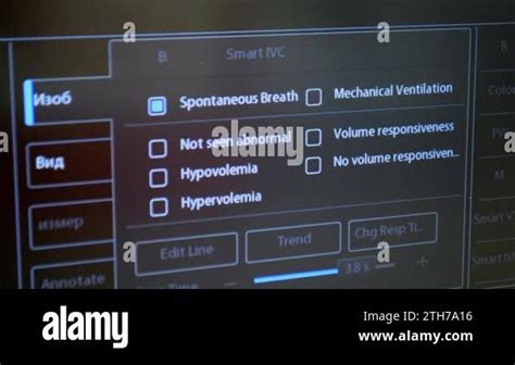 Utrasound Image On The Monitor Close Up Ultrasound Scan Display Ultrasound Scan Device