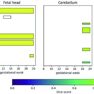 Overview Of The Dice Score For Segmentation Of The Fetal Head In The Download Scientific