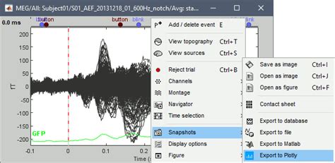 tutorials plotly brainstorm