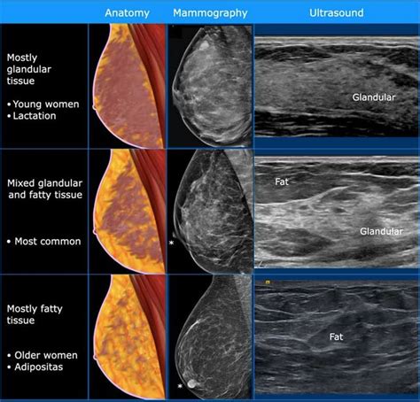 Ultrasound Of The Breast Imágenes De Ultrasonido Radiodiagnóstico