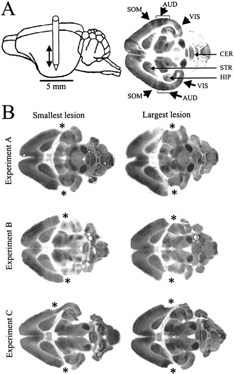 Bilateral Ablation Of Auditory Cortex In Mongolian Gerbil Affects Discrimination Of Frequency