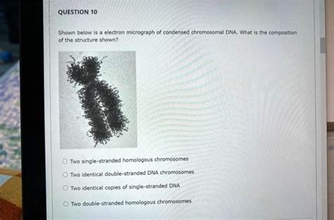 Question 10 Shown Below 3 Electron Micrograph 0f Condanked Chromosomal Dna What Tha Composltion