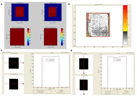 Dosimetric Evaluation Of Calculated And Measured Dose Distributions Download Scientific