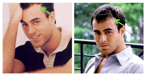 Enrique Iglesias Hair Loss