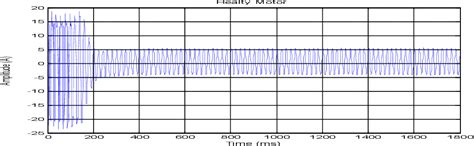Figure 3 From Predictive Diagnosis Of Unbalance And Misalignment Defects Based On The Fft And