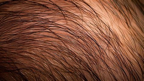 The Follicle Stimulating Hormone Muscle Growth Expert