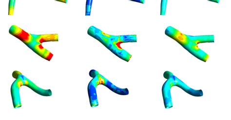 Personalised Modelling Sydney Vascular Modelling Group Unsw Sydney