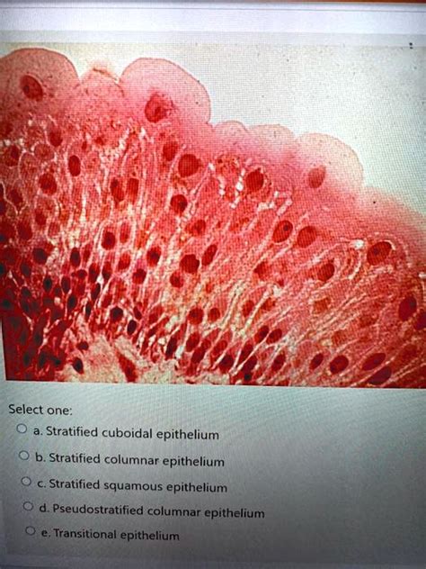 Stratified Cuboidal And Columnar Epithelium My Xxx Hot Girl