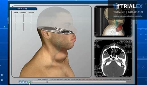 Injury Review Slice Chooser And Fetal Heart Monitor Graphic