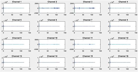 EEG Raw Signal Recordings For The Activity Working Download Scientific Diagram