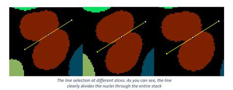 Github Prubiocosta 3d Cell Segmentation With Imagej