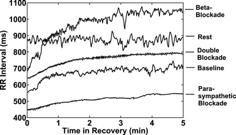 RR Interval Plots During Preexercise Rest And For The First Min Of Download Scientific