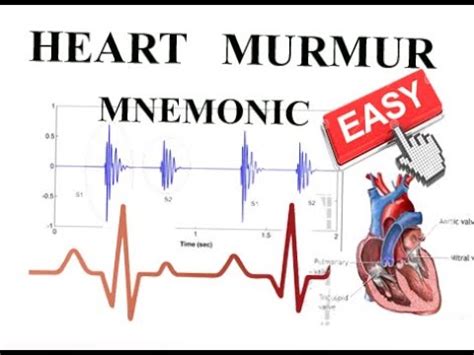 Mnemonics For Heart Sounds