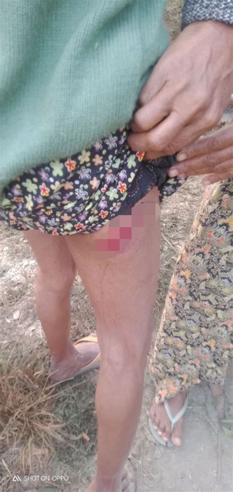 အကြမ်းဖက် စစ်ကောင်စီက မင်းပြားမြို့ကို ဂျက်လီယာဥ်နန့် ဗုံးကြဲ၊ အပြစ်မဲ့ပြည်သူ ၁ ယောက်ဒဏ်ရာရပြီး