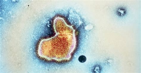 Pfizers Maternal Rsv Vaccine First To Win Fda Panel Support Time