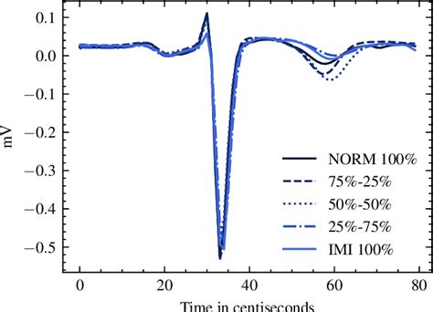 figure 4 from diffusion based conditional ecg generation with