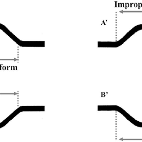 Appropriate Measurement Of P Wave Duration Download Scientific Diagram