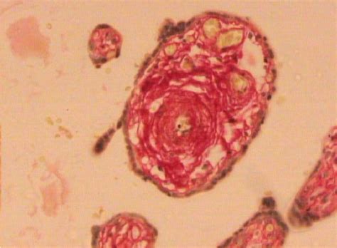 Diffuse Calcifications Col He Download Scientific Diagram