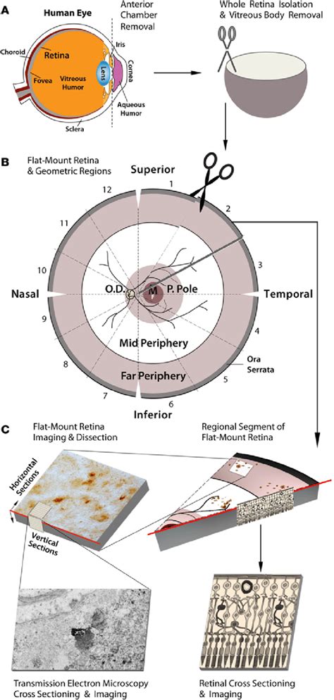 Schematic Diagram Of Donor Eye Dissection Retinal Isolation And