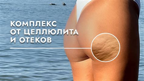 Убираем целлюлит и отеки за 10 минут Youtube