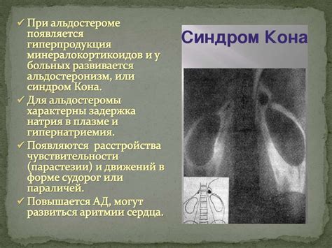 Болезни эндокринной системы презентация онлайн