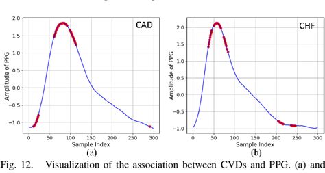 Figure 12 From Inferring Electrocardiography From Optical Sensing Using Lightweight Neural
