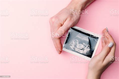 초음파 사진 임신 한 아기 사진 분홍색 배경에 초음파 임신 이미지를 들고있는 여성의 손 임신 출산 아기 출산에 대한 기대의 개념 2명에 대한 스톡 사진 및 기타 이미지