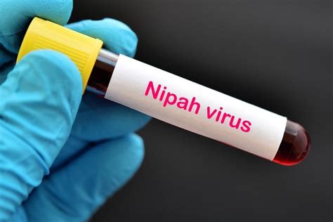 Foto Waspadai Penyebaran Virus Nipah Kemenkes Keluarkan Surat Edaran