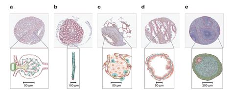Exemplary Tissue Microarray Cores With Ftu Segmentations Outlined In