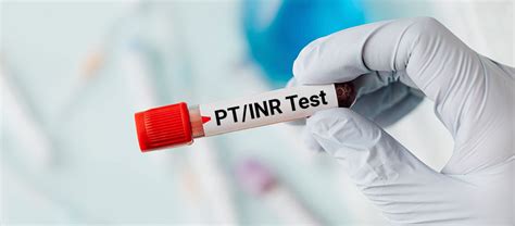 Prothrombin Time Pt Inr Test Normal Range Purpose And Risks