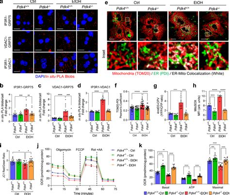 Pdk4 Deficiency Suppresses Etoh Induced Mam Formation And Mitochondrial
