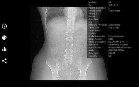 Dicom Viewer For Android Free Download Fasrknowledge
