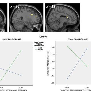 Brain Areas Within Which There Were Significant Sex Differences During