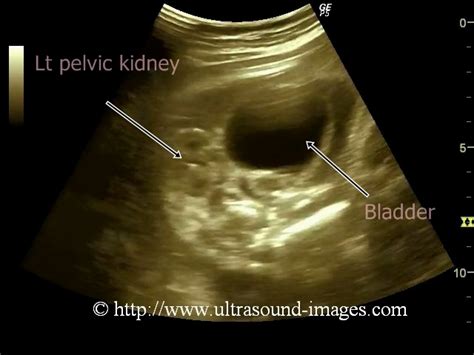 A Gallery Of High Resolution Ultrasound Color Doppler And 3d Images