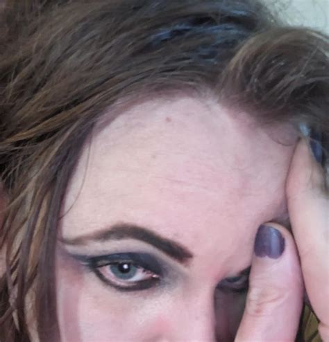 Ive Had An Undiagnosed Recurring Inflammatory Condition For A While And Just Noticed This