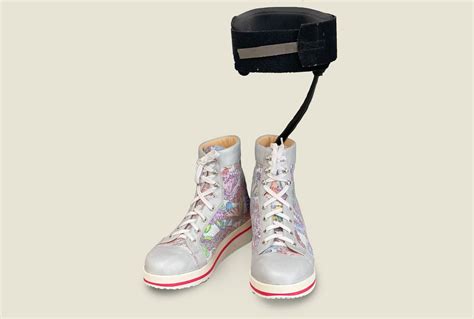 Hemiparesis Stroke Related Feet In Focus