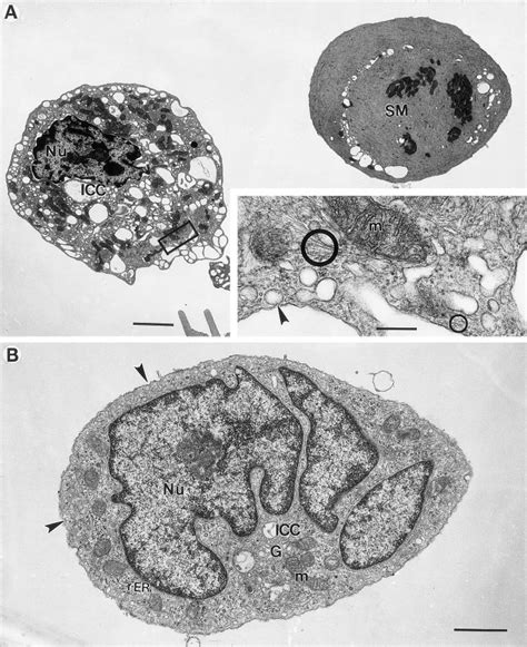 Electron Micrographs Of Freshly Isolated Cells A Low Magnification Download Scientific