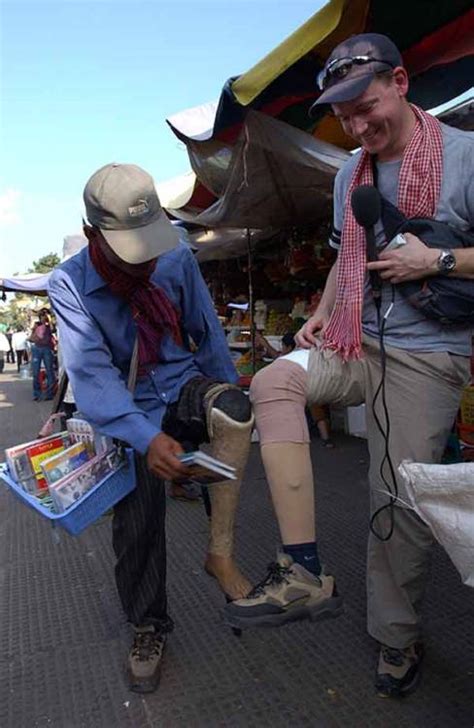 Comparing Prosthetics Tumbex Comparing Prosthetics Tumbex
