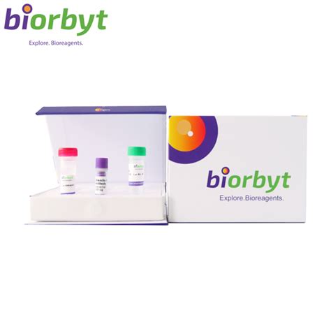 Orb1931144 100ul Phospho Tsc2 S1798 Antibody Clinisciences