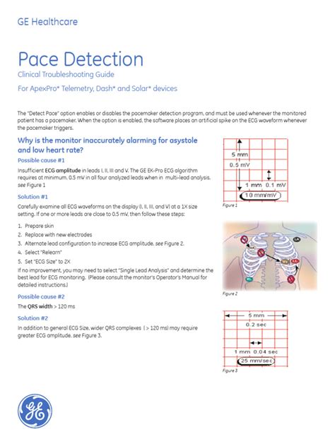 Pace Detectionclinical Troubleshooting Guidedoc1018666 Pdf
