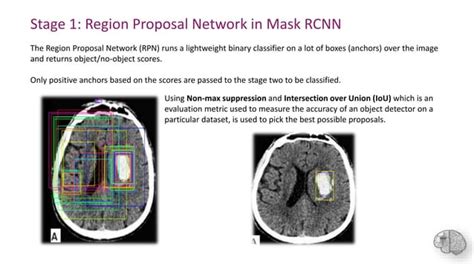 Application Of Masked Rcnn For Segmentation Of Brain Haemorrhage From Computed Tomography Images