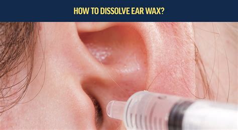 How Do I Dissolve Ear Wax Axel Glade