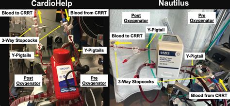 Using Cardiohelp Quadrox And Nautilus Extracorporeal Membrane