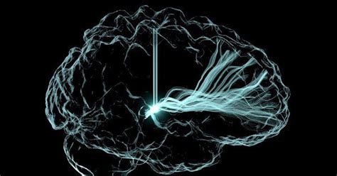 외상성 뇌 손상 환자 뇌에 전극 꽂으니 인지 능력 개선됐다”