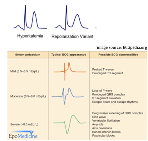 117 This Lab Is Bananas B A N A N A S Hyperkalemia In The Acute
